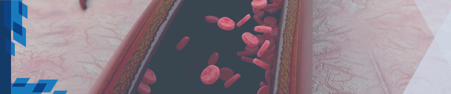 Oberdorfer Pumps for Embalming | Precision Fluid Handling